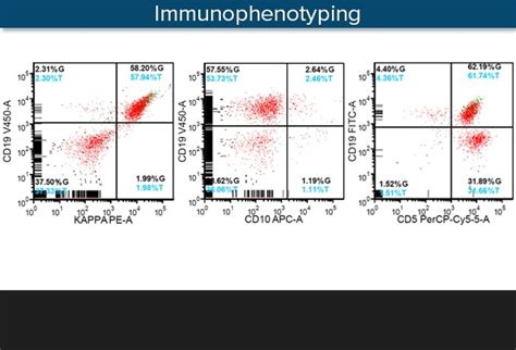 Mantle Cell Lymphoma Diagnosis And Differentiation