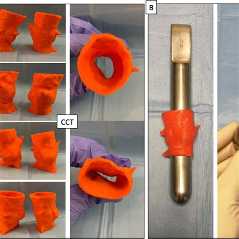 A 3d Printed Model Of The Aortic Root From Cmr And Cct Of The Same