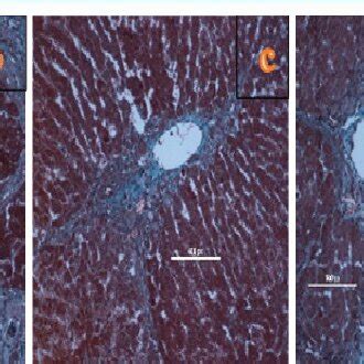 Histology Slices Of Liver Stained With Masson Trichrome A Normal