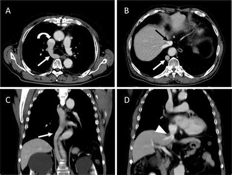 Preoperative Contrast Enhanced Computed Tomography Ct A Ct