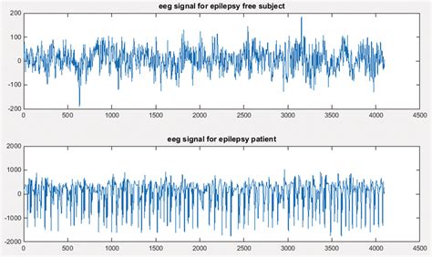 Eeg Signal For Epilepsy Free Subject And Epileptic Patient Download