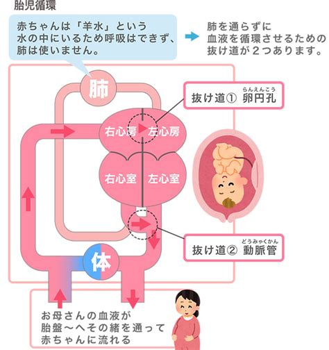 動脈管開存症 日本小児循環器学会【一般の方へ】