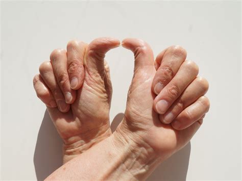 Weird Joints