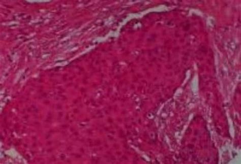 Novus Biologicals Human Skin Tissue Microarray Slide Human Skin Tissue