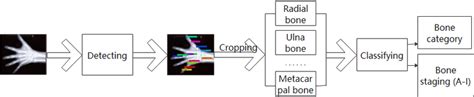 Bone Age Prediction Model Based On Convolutional Neural Network 1 Download Scientific Diagram