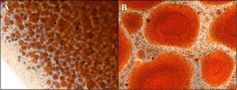 Light Microscopic Findings Of The Water In Oil Emulsion Showing Small