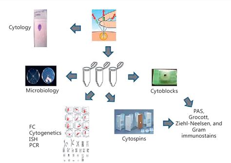 Table 1 From A Basic Approach To Lymph Node And Flow Cytometry Fine