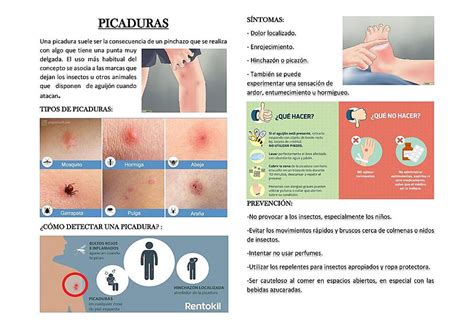 Guía completa sobre picaduras: Tipos y tratamiento - Oliver Futur - Control de plagas
