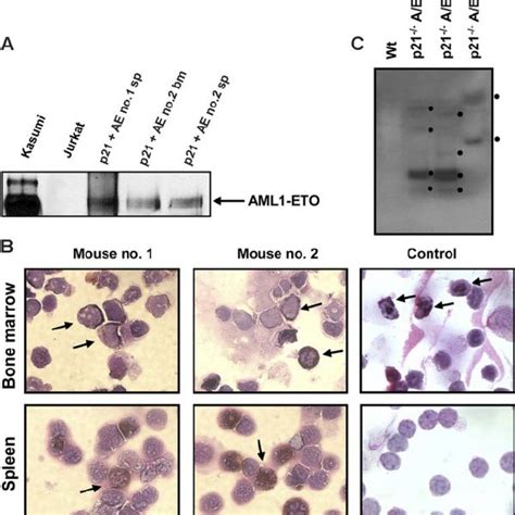 Aml1 Eto Promotes Leukemia In P21 Waf1 Deficient Mice A