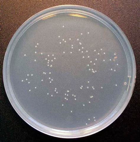 Scharlab Tryptone Yeast Extract Agar Tryptone Yeast Extract Agar Form Solid Dehydrated