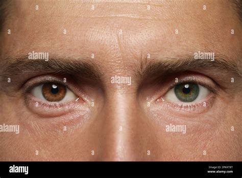 Man With Beautiful Eyes Of Different Colors Closeup Heterochromia