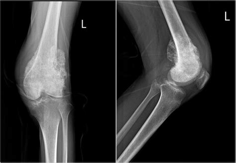 ГССҮТ ИЙН ЭМЧ НАР ЯСНЫ ХОРТ ХАВДАРТАЙ ХЭСГИЙГ БҮРЭН АВЧ ХИЙМЭЛ ЯС ҮЕ СУУЛГАХ МЭС ЗАСЛЫГ