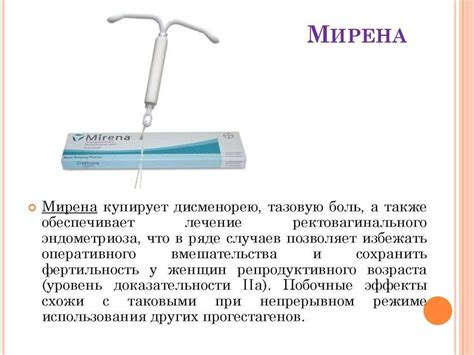 Внутриматочная спираль: виды, цены, как выбрать лучшую - мирена, юнона ...
