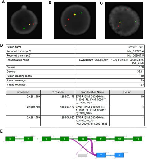 identification of a previously uncharacterized ews fli1 fusion