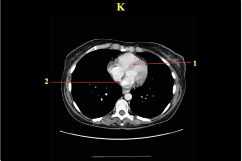 Csa 10 Diagram Quizlet