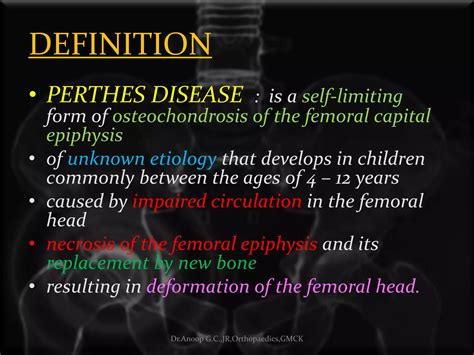 Classification Perthes Disease Pdf