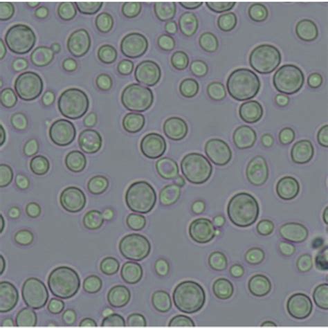 Fermentative Sugar Metabolism Of L Thermotolerans Adapted From Kyoto