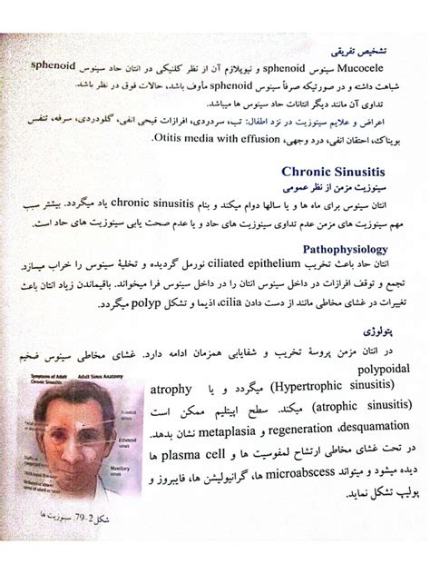 Chronic Sinusitis Pdf