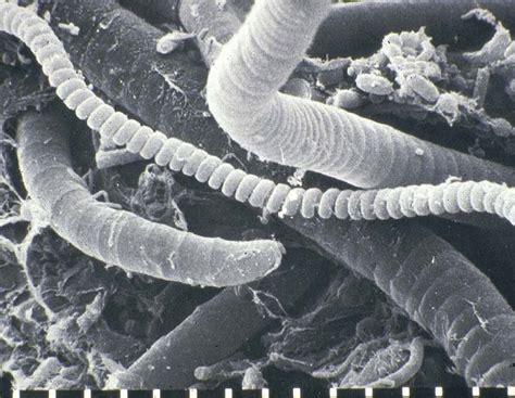 Sem Micrograph Of A Section Of A Microbial Mat From The Mellum Download Scientific Diagram