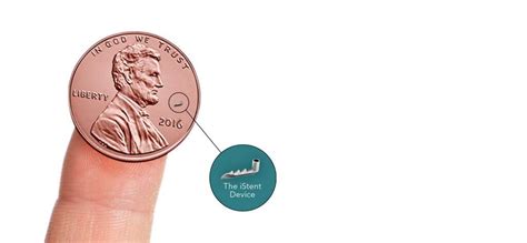 Istent® Glaucoma Surgery And Treatment In Manhattan New York Nyc