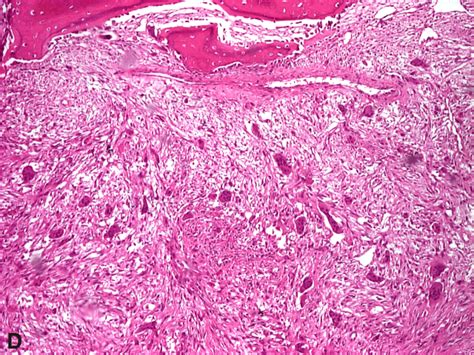 Histopathology Images In Hematoxylineosin He Staining Showing