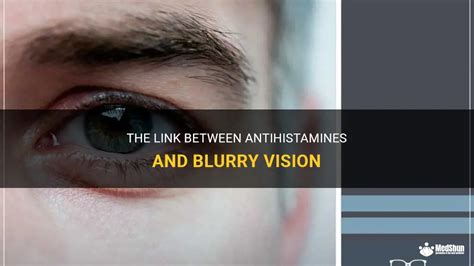 The Link Between Antihistamines And Blurry Vision Medshun