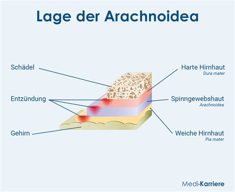 Arachnoidea Spinngewebshaut Anatomie Medi Karriere
