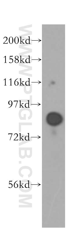 Hook1 Antibody 10871 1 Ap Proteintech