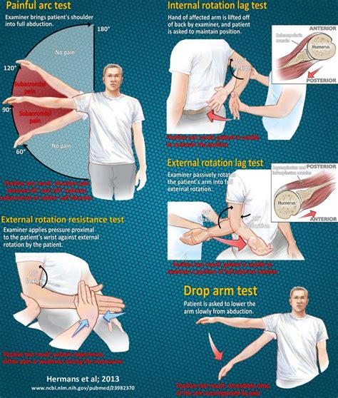 Distal Biceps Tendonitis Exercises That Reduce Pain Bicep Tendonitis