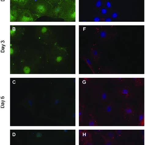 Classification Of Annotated Microarray Entries Based On Gene Function