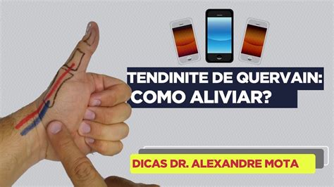 Al Vio R Pido Para Tendinite De Quervain Em Minutos