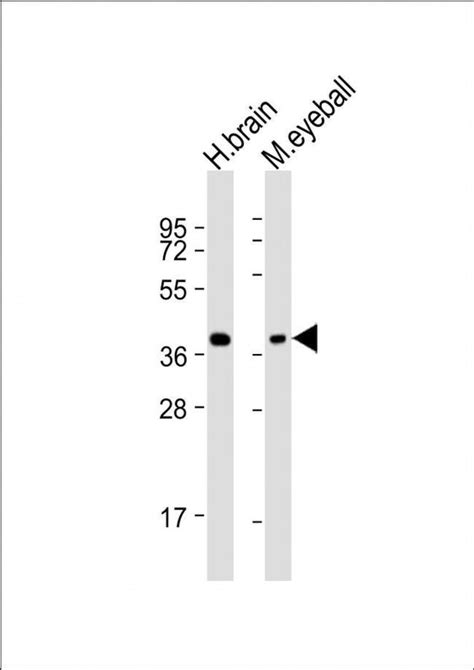 Arr3 Polyclonal Antibody Invitrogen 200 μl Unconjugatedantibodies