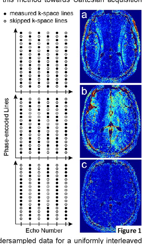 Figure 1 From Nonlinear Inverse Reconstruction For T 2 Mapping From Highly Undersampled