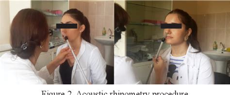 Figure 2 From Prevalence And Causes Of Nasal Obstruction After