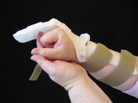 Flexor Tendon Injuries Hand Orthobullets