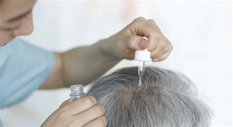 Non Surgical Treatments Kensington Hair Clinic