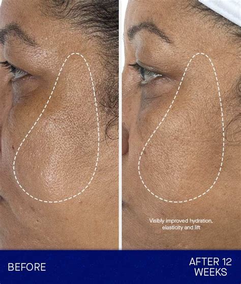 The Serum Augustinus Bader Us