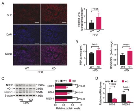 Bba丨irg1 敲除通过抑制 Akt从而加剧高脂饮食诱发的非酒精性脂肪肝 知乎