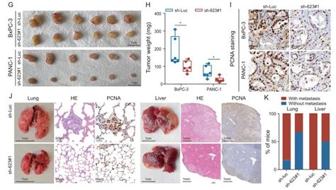 科研思路丨j Hematol Oncol（if23）丨外泌体lncrna测序助力发现linc00623促进胰腺癌进展的分子机制 知乎