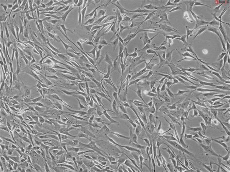 Human Aortic Adventitial Fibroblasts Haaf Sciencell Research Laboratories