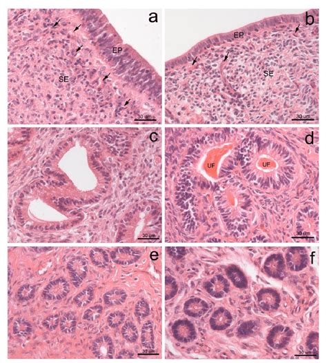 Light Microscopic Photographs Of The Uterine Epithelium A B The