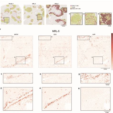Differences In The Spatial Organization Between Healthy And Systemic