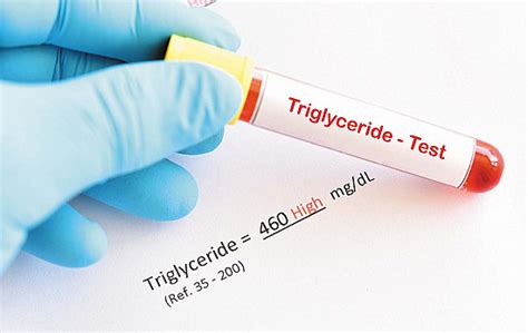 Taming High Triglycerides Harvard Health