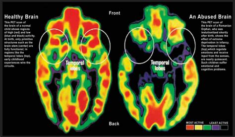 Як любов розвиває мозок Моє пташення