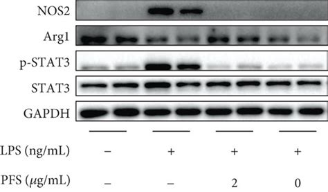 Immunomodulatory Effects Of Pfs On Lps Induced M1 Macrophage