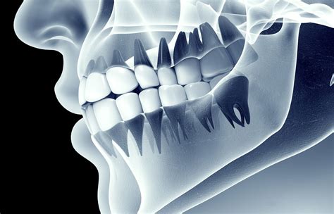 Cbct Scan Drbk Cosmetic Dentist And Aesthetics Clinic In Reading