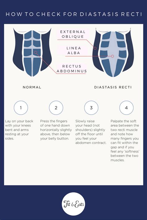 How To Check For Diastasis Recti Video Included Fit And Eats