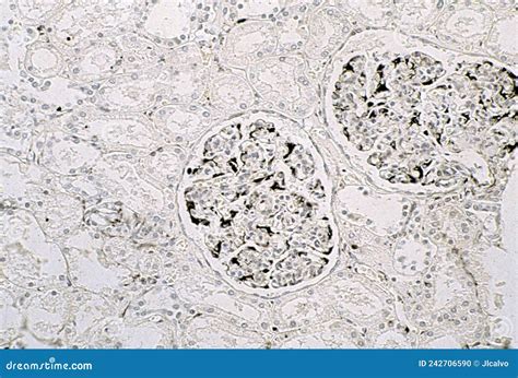 The Renal Corpuscle Or Bowmans Capsule Structure Vector Illustration