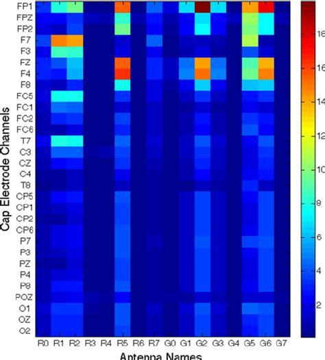 Forward Model Matrix Shows The Eeg Electrode Signal Amplitudes μv