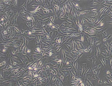 MDA MB 231 DMEM 人乳腺癌细胞 思泰默细胞